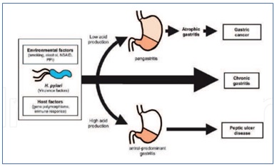 Assessment of Helicobacter pylori infection – International Journal of ...
